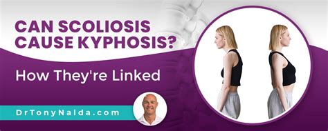 Kyphoscoliosis Causes Symptoms And Treatment Kyphosis What Is It