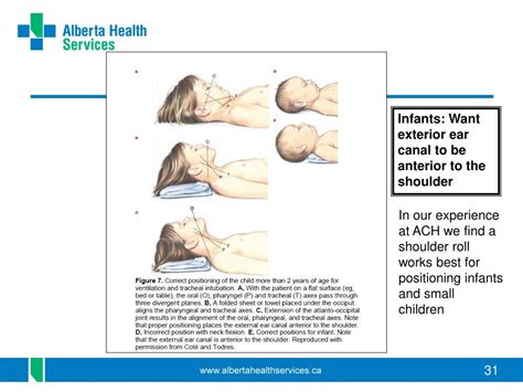 Ppt Pediatric Airway Management Powerpoint Presentation Free