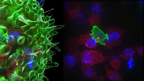 Killer T Cell The Cancer Assassin — The Wonder Of Science
