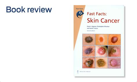 Skin Tumour Basics For Beginners The Medical Journal Of Australia