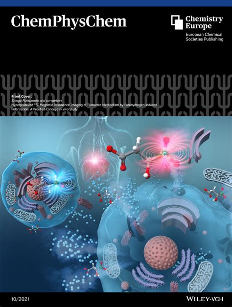 Front Cover Hyperpolarized 13c Magnetic Resonance Imaging Of Fumarate Metabolism By