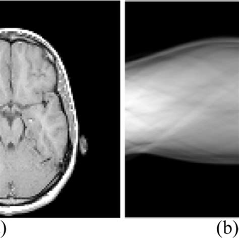 Radon Transformation Of Medical Images A Original Image B The Download Scientific Diagram