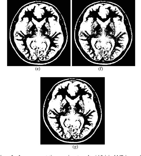 Figure 2 From Medical Image Segmentation Based On 2d Maximum Fuzzy