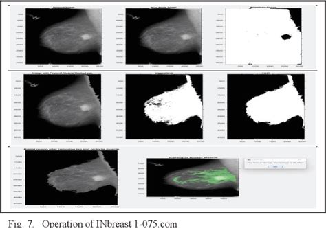 Figure 3 From Automated Breast Density Assessment Using Image Processing Techniques Semantic