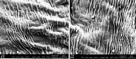 Scanning Electron Micrographs Sem Of Fruit Surface Of C Siifolium