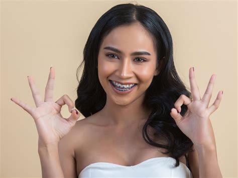What Are The Benefits Of Braces Besides Straight Teeth