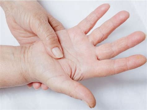 Trigger Finger Episodes Physio Rehab