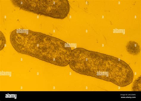 False Colour Transmission Electron Micrograph Of The Bacteria Salmonella Typhimurium In The