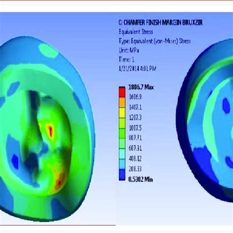 Pdf Influence Of Shoulder And Chamfer Margin Design On The Stress Distribution Pattern In