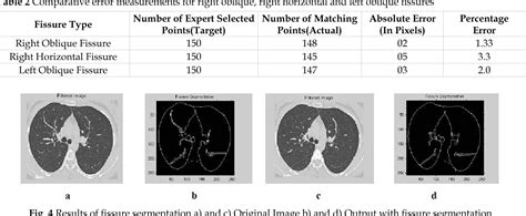 Figure 4 From Fissure Detection In Lung Ct Images Using Back Propagation Neural Networks