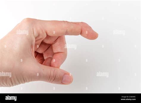 Cut Index Finger With A Extensor Tendon Injury Mallet Finger Wound Cut Index Finger With A Extensor Tendon Injury Mallet Finger Wound