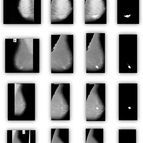 Segmentation Results Leftright Original Image Pectoral Muscle