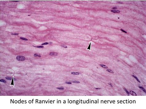 Peripheral Nerve Histology Nodes Of Ranvier