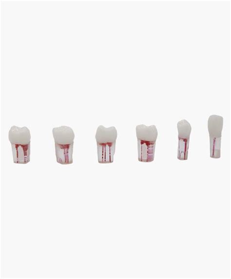 Root Canal Model Fm E001 Feiman
