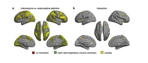 Figures And Data In Anterior Insular Cortex Plays A Critical Role In