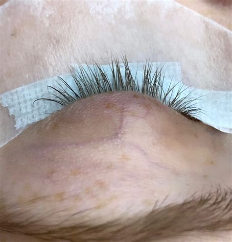 Lash Patch Test Why It Is Important And How To Do CharmLash