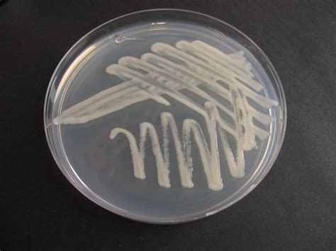 Retina Agrobacterium Rhizogenes Rhizobium Rhizogenes