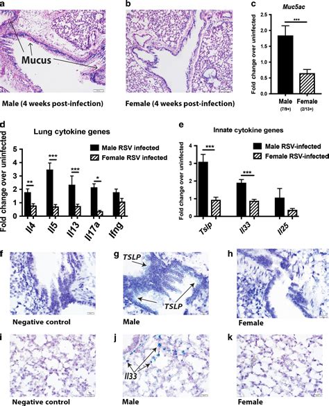 Sex Associated Tslp Induced Immune Alterations Following Early Life Rsv
