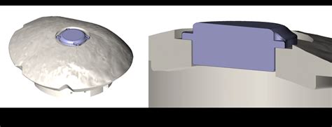 Here S How Neuralink Is Modifying Its Brain Chip For Second Human Patient