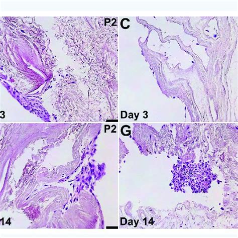 Histologically Assessed Normal And Decellularised Sheep Uterus Defined