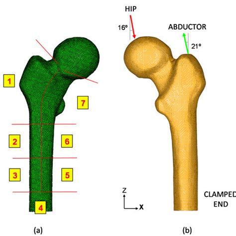 3d Fe Model Of Proximal Femur A Adaptation Of Gruen Zones To The
