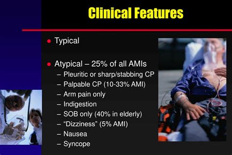 PPT Acute Coronary Syndromes PowerPoint Presentation Free Download ID 818600
