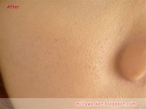 Best Skin Texture Images On Pinterest Texture Human Body And Face Skin