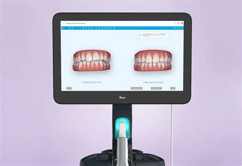 ITero Customer Learning Center NA ITero Element 5D Plus Lite