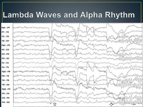 Lambda Waves