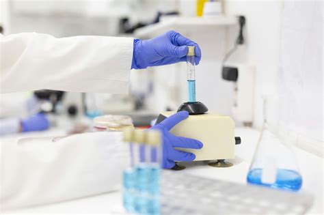 Lab Test Validation At Alex Mckean Blog