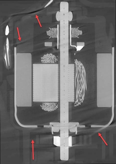 An Introduction To Ct Scan Image Artifacts North Star Imaging