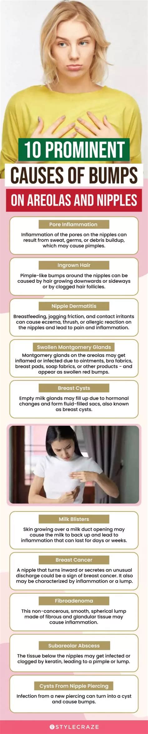Bumps On Areola And Nipples Causes Diagnosis And Treatment