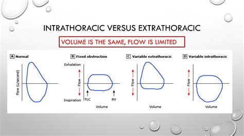 Obstructive And Restrictive Lung Disease Ppt Video Online Download