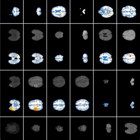 24 Examples Of Pairs Of Synthetic Mr Images And Corresponding Synthetic