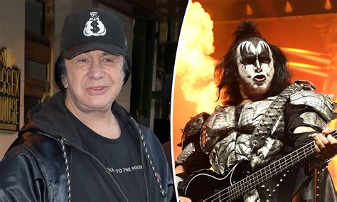 Cirugia Plastica Gene Simmons