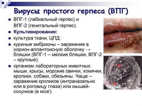 Вирусы герпеса - презентация онлайн