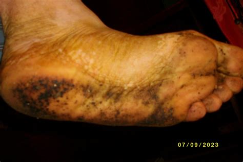 Do You Think My Soles Are Rough Enough Rroughmalefeet