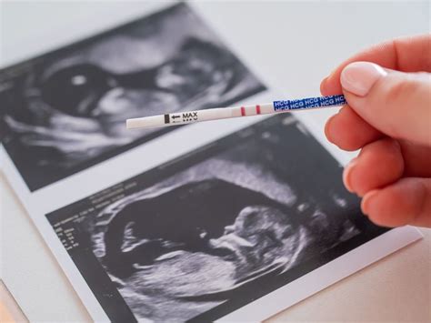 Embryo Grading In Ivf What Does These Numbers Really Tell You