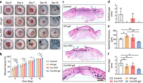 北化徐福建教授团队和中国医大一院杨茂伟教授团队 Acs Ami：基于糖胺聚糖水凝胶递送系统调控伤口微环境以拯救慢性伤口愈合 中国聚合物网科教新闻