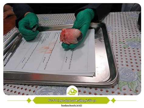 آشنایی با ساختار چشم پایه‌ی پنجم