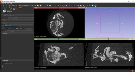 Problems With Volume Rendering Support 3d Slicer Community
