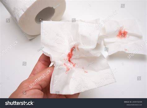 Rectal Bleeding Images Stock Photos Vectors Shutterstock