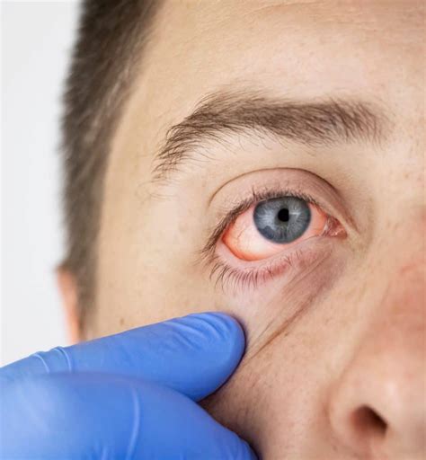 Arythmie Sinusale Dr Learnycare