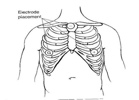 Electrocardiography Flashcards Quizlet