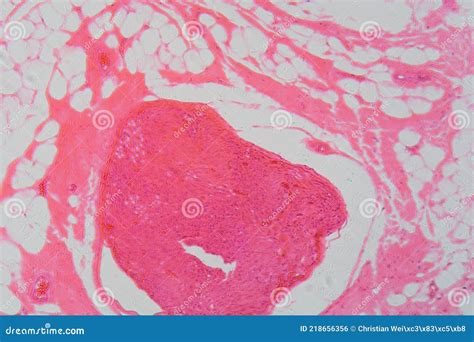 Cross Section Of Human Nerve Cells Under The Microscope Stock Photo Image Of Neurology