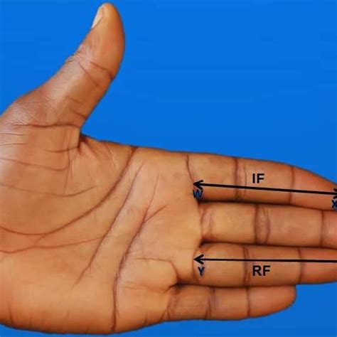 Comparison Of Index And Ring Finger Lengths In Adolescent And Adult Download Scientific Diagram
