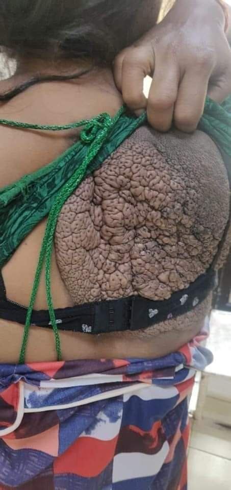 This Isnt My Post But I Am Dying To Find Out What This Is R Dermatology