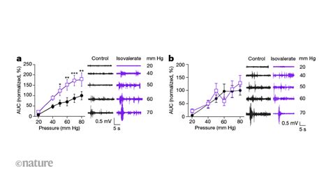 Dialogue Between Specialized Gut Cells And Nerves Contributes To Sex Bias Of Gut Pain
