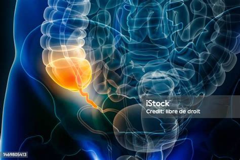 맹장염 질환 또는 Vermiform 맹장 염증 3d 렌더링 그림 해부학 수술 생의학 질병 의료 생물학 과학 건강 관리 개념 3차원 형태에 대한 스톡 사진 및 기타 이미지