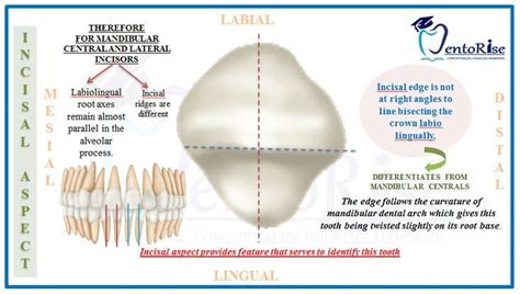 Permanent Mandibular Lateral Incisor Tooth Morphology Dental